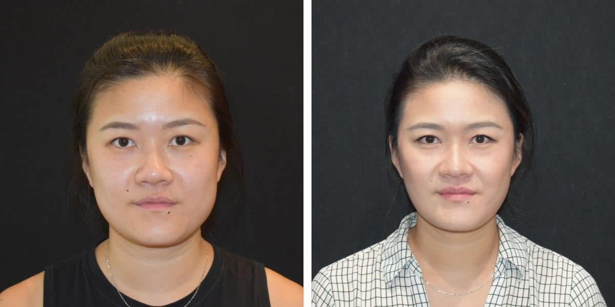 How To Get A Better Jawline | Dr. Sarah Saxon