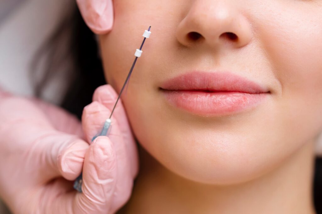 Thread Lift Vs Facelift : Which Is Right For You?