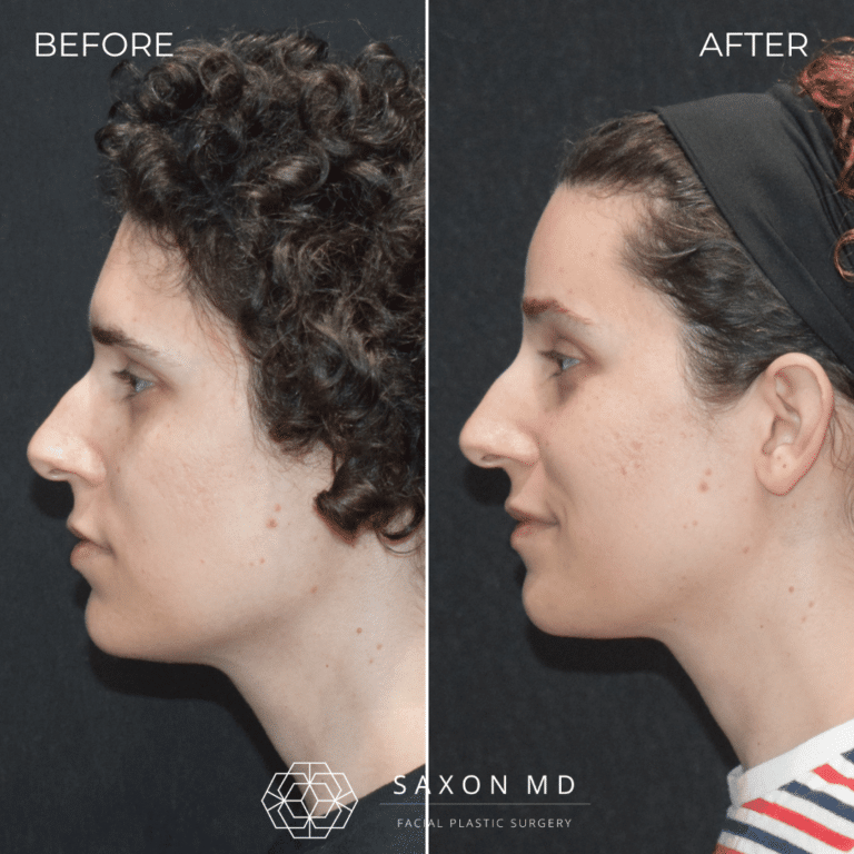 How To Get A Smaller Forehead | Dr. Sarah Saxon