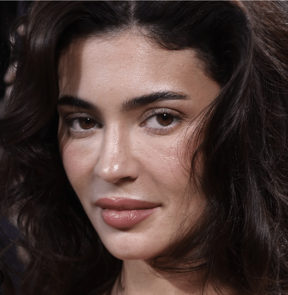 Alternatives To Tear Trough Filler - Dr. Sarah Saxon