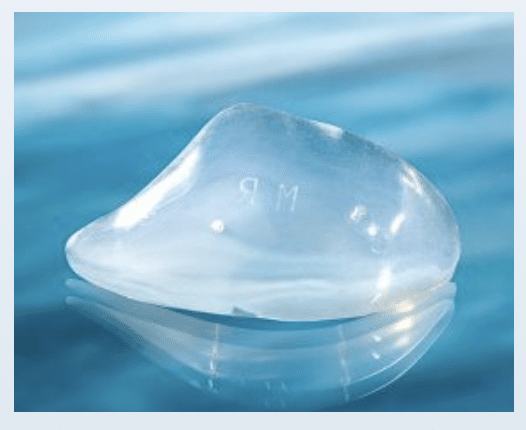 A Comprehensive Guide To Different Types Of Cheek Implants