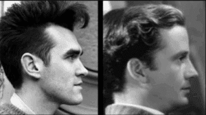 How To Reshape A Sloped Forehead | Dr. Sarah Saxon