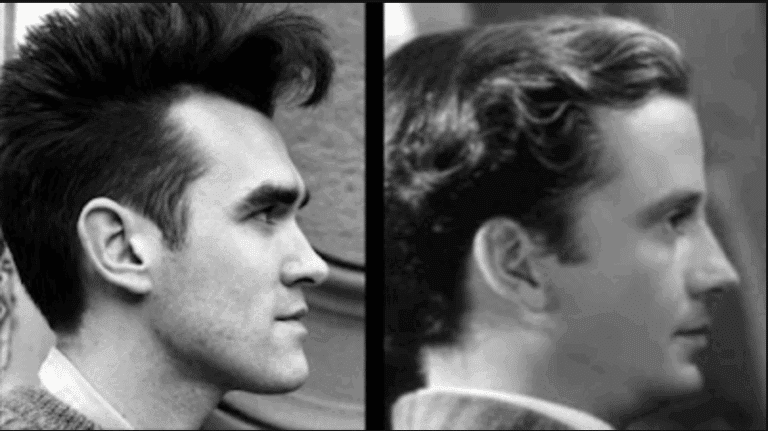 How To Reshape A Sloped Forehead | Dr. Sarah Saxon