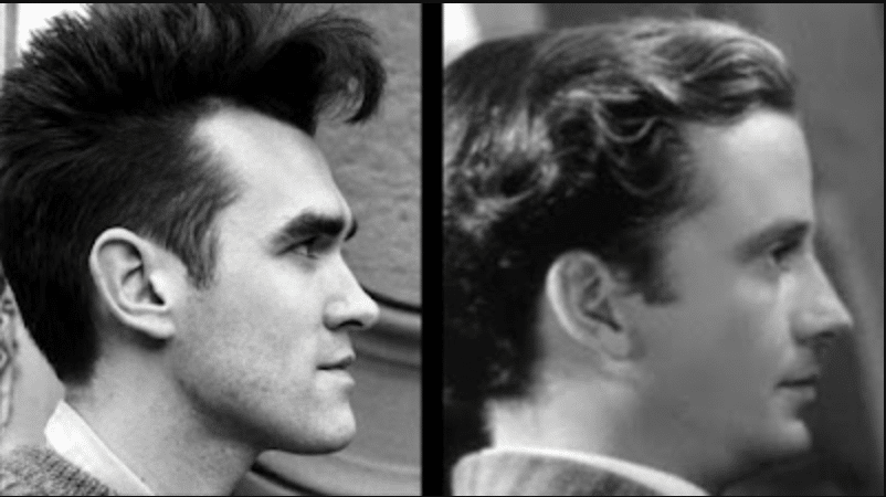 How To Reshape A Sloped Forehead | Dr. Sarah Saxon