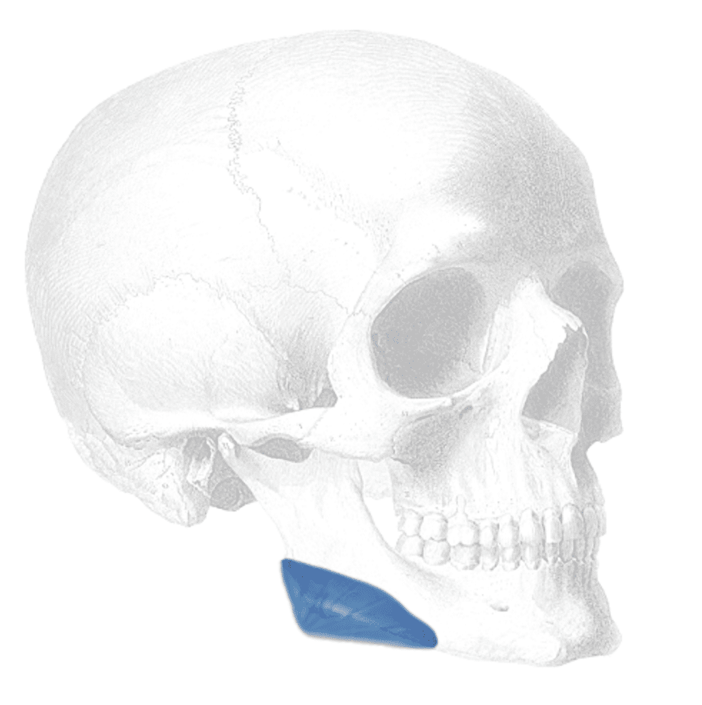 Jaw Angle Implants: A Complete Guide